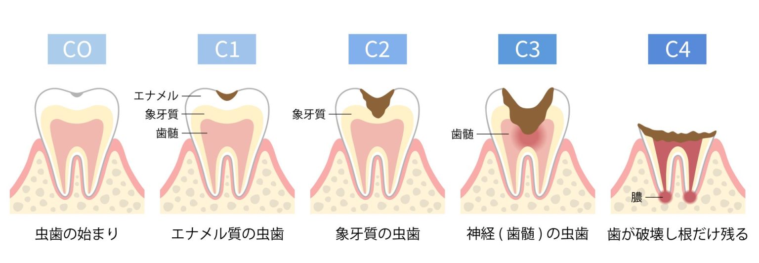 歯の奥が痛い原因6選！放置すると危険なサインと今すぐできる応急処置 - 陽光台ファミリー歯科クリニック